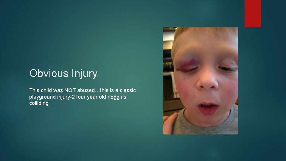 Elder Abuse The Podiatric Medical Assistants Role in