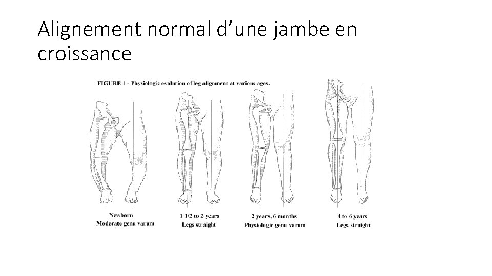 valuation des membres infrieurs et de la dmarche