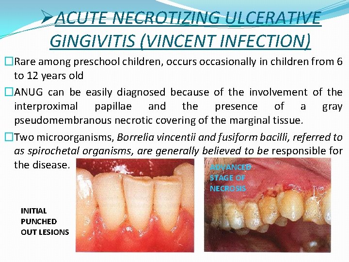 NORMAL PERIODONTIUM AND GINGIVAL DISEASES IN CHILDREN INTRODUCTION