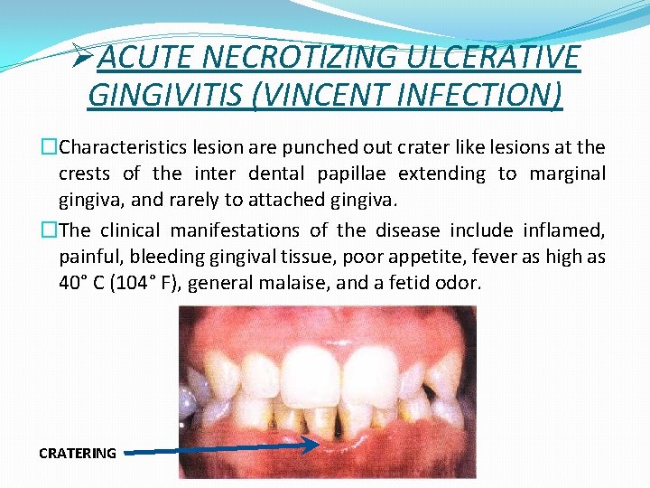 NORMAL PERIODONTIUM AND GINGIVAL DISEASES IN CHILDREN INTRODUCTION