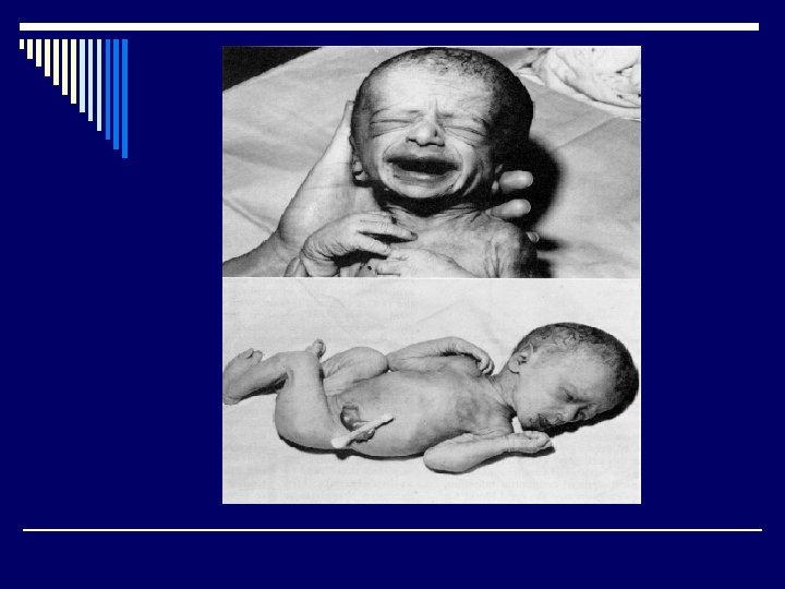 Premature Birth and Low Birth Weight Prevention Family