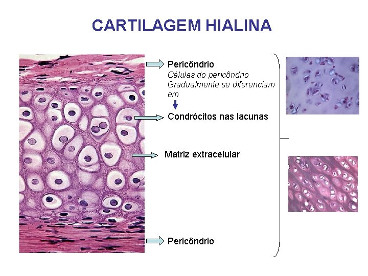 CAPTULO 5 HISTOLOGIA DO TECIDO CARTILAGINOSO Profa Ivana