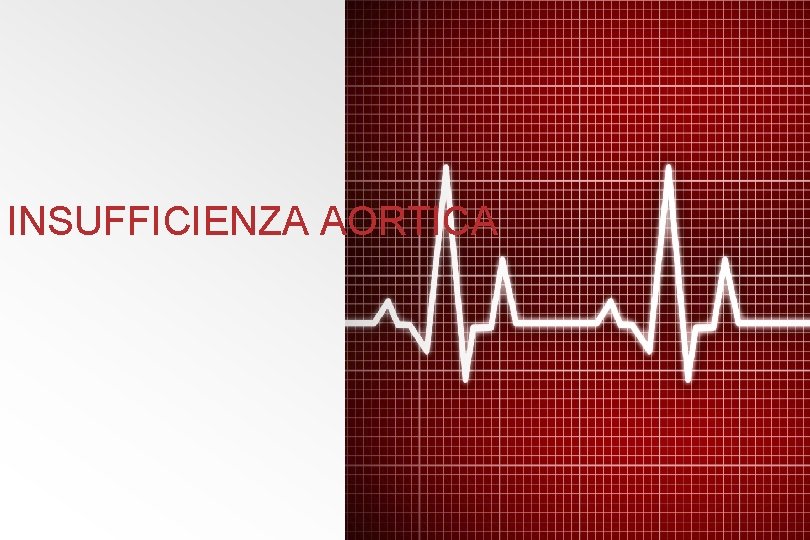 Valvulopatia Aortica Stenosi aortica Insufficienza aortica ...