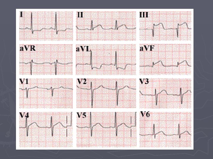Cardiac Cycle The two atria contract at the