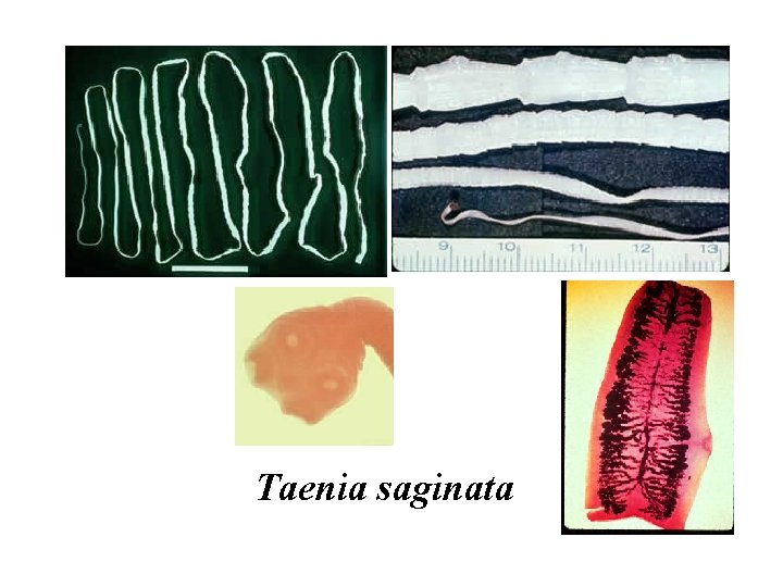Tapeworms Cestodes Common Tapeworm Infections LAB TAPEWORM Taenia