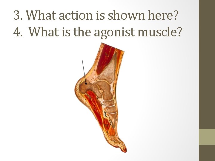Muscle Joint Lab Practical 50 pts You may