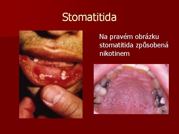 Poruchy a nemoci trvic soustavy Trvic soustava Zubn