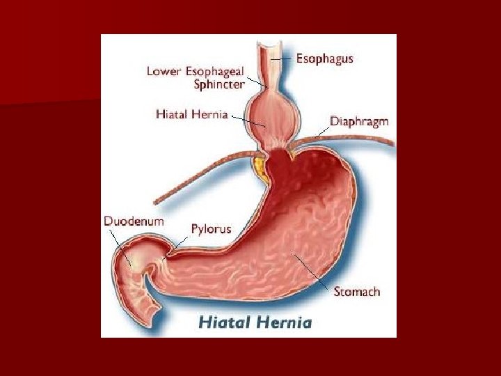 Poruchy a nemoci trvic soustavy Trvic soustava Zubn