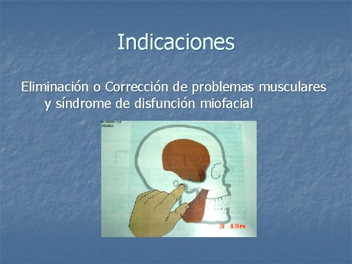 AJUSTE OCLUSAL POR DESGASTE SELECTIVO Facultad de Odontologa