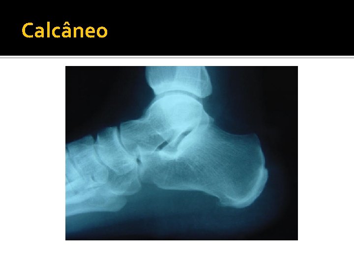 Membro Inferior Sistema Esqueltico Funo Sustentao do peso