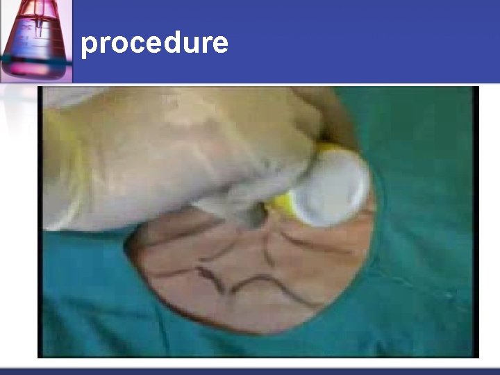 Serous fluid 2 By Dr Mohammed Shaat Anatomy