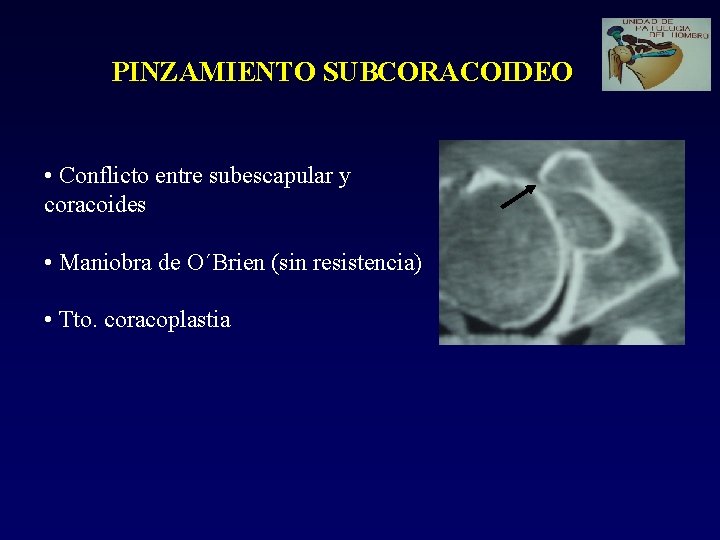 PATOLOGA DEL HOMBRO Y DEPORTE Alternativas teraputicas CONGRESO