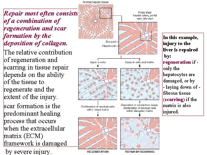 Chapter 3 Tissue repair Regeneration Healing Fibrosis Critical