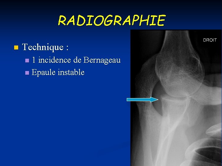 IMAGERIE MEDICALE EPAULE FMC MINIMES 21 OCTOBRE 2010