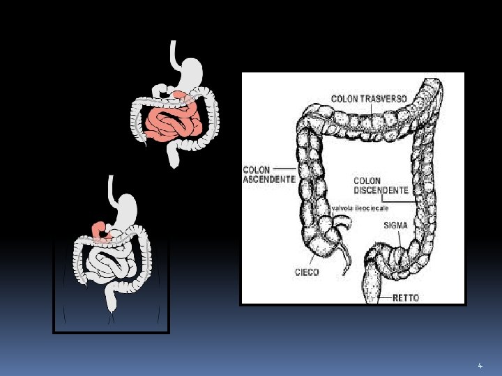 Assistenza alla persona sottoposta a resezione del colonretto