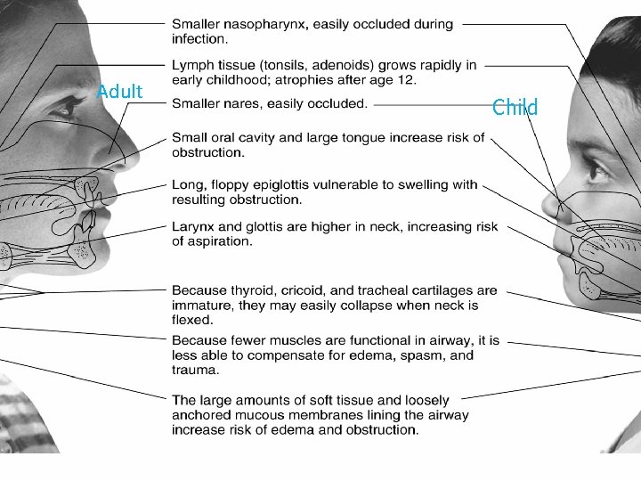 Acrocyanosis Cyanosis bluish coloration observed at the distal