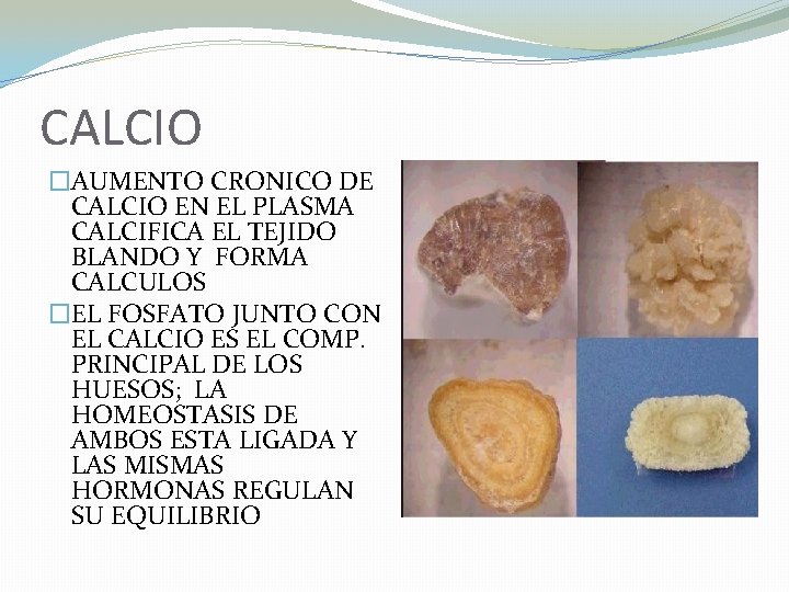 HOMEOSTASIS DEL CALCIO CALCIO MINERAL MAS ABUNDANTE EN