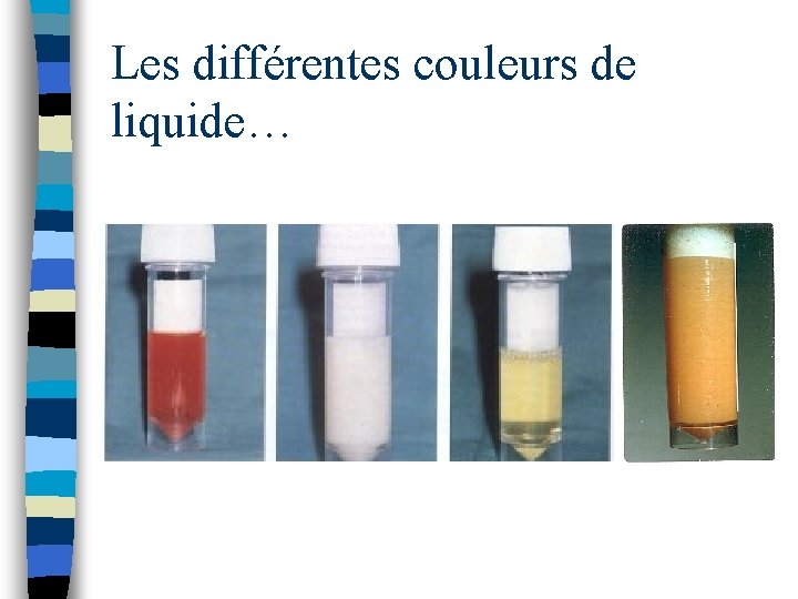Syndrome dpanchement pleural arique et liquidien Anatomie de