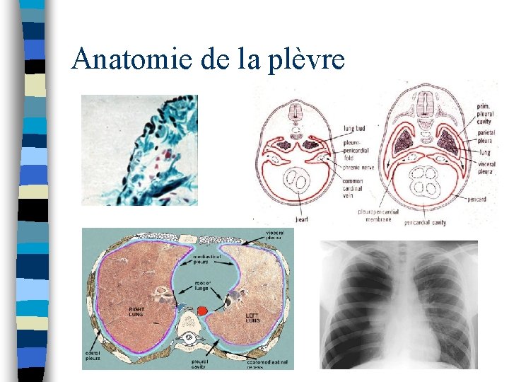 Syndrome dpanchement pleural arique et liquidien Anatomie de