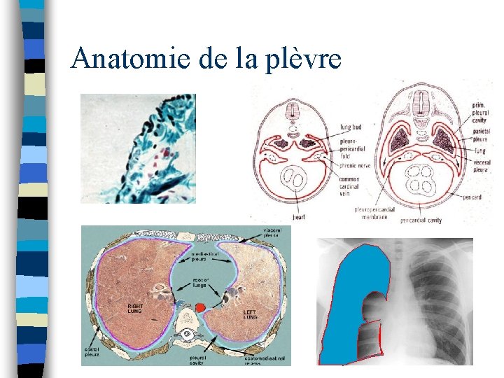 Syndrome dpanchement pleural arique et liquidien Anatomie de