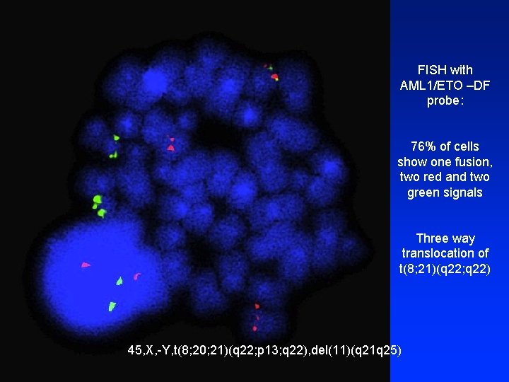 Can Cytogenetics and FISH survive in the modern