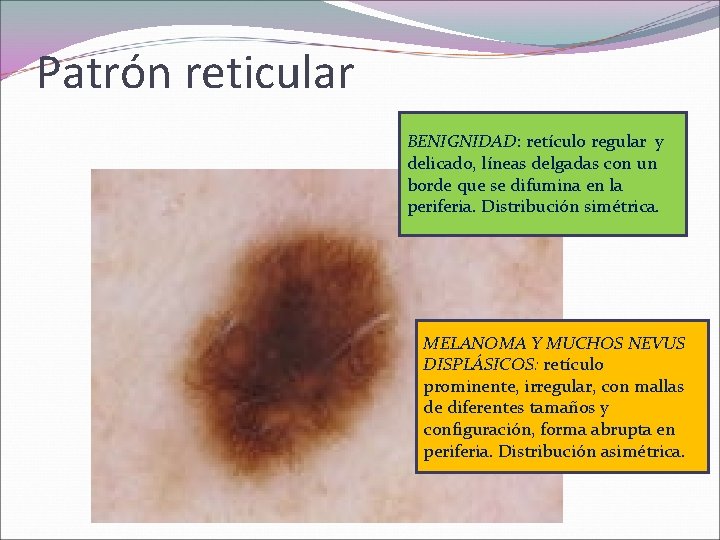 USO DEL DERMATOSCOPIO EN AP MARTA FERRER ROYO