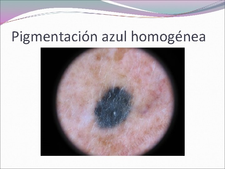 USO DEL DERMATOSCOPIO EN AP MARTA FERRER ROYO