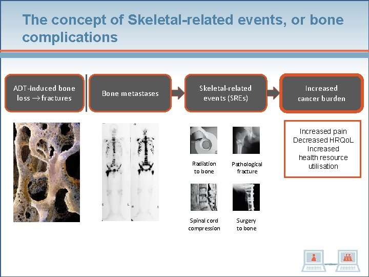 It takes more than milk to improve bone