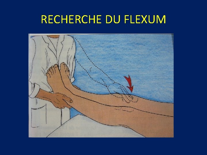 FLEXUM DU GENOU GENU FLESSUM Dfinition DEFAUT DEXTENSION