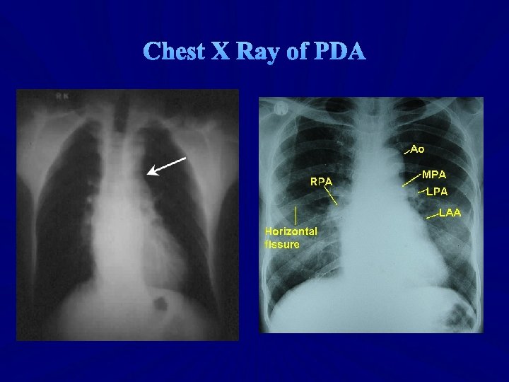 website www drsarma in Cardiology Bedside Clinics Interesting