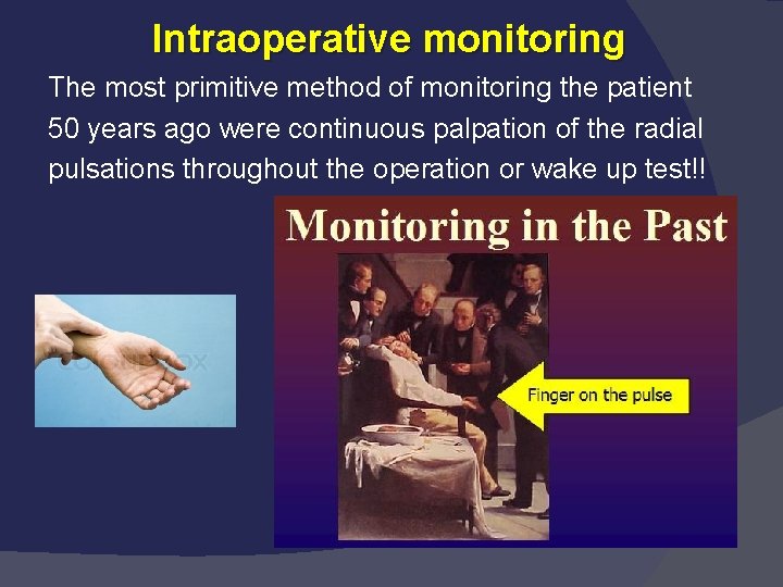Intraoperative Monitoring Behrouz Zamanifekri MD Neurophysiology Fellow ...