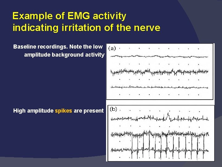 Intraoperative Monitoring Behrouz Zamanifekri MD Neurophysiology Fellow ...