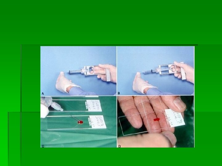 Cytology and Cytological Techniques Clinical Pathology Cytology The