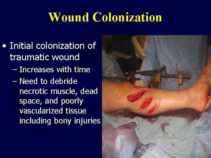 Wound Coverage Techniques for the Injured Extremity Gil