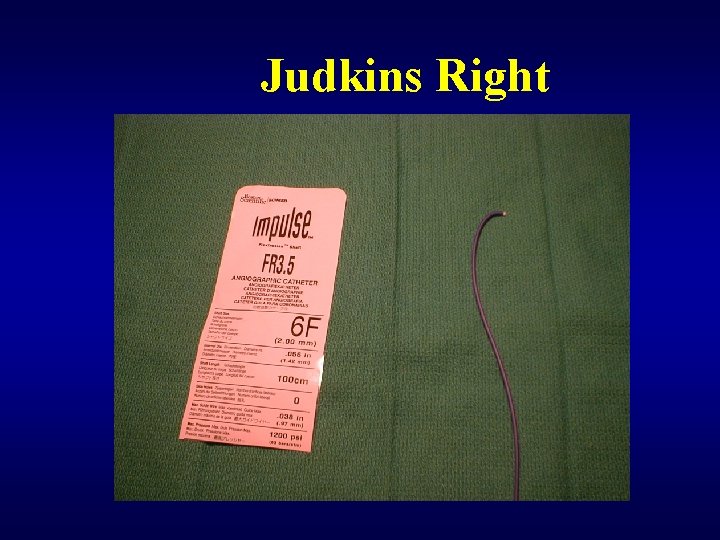 Catheter Based Percutaneous Coronary Angiography The Byrne Identity