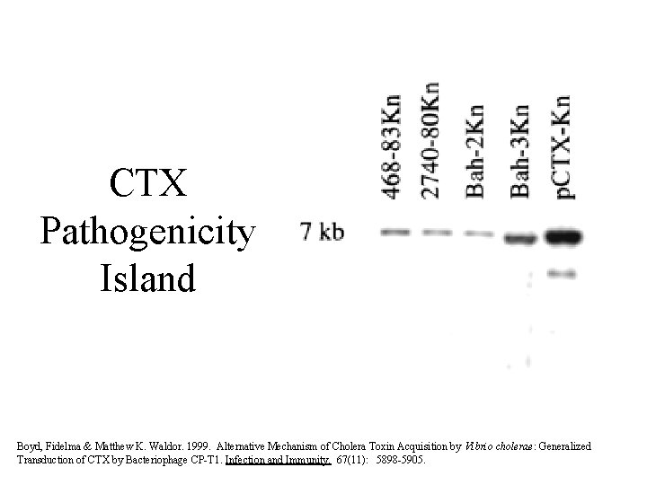The Vibrio cholerae Toxin CoRegulated Pilus TCPtargeted Vaccine