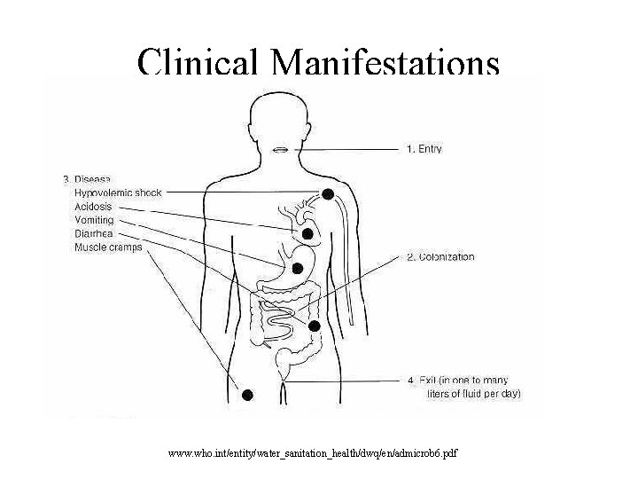 The Vibrio cholerae Toxin CoRegulated Pilus TCPtargeted Vaccine
