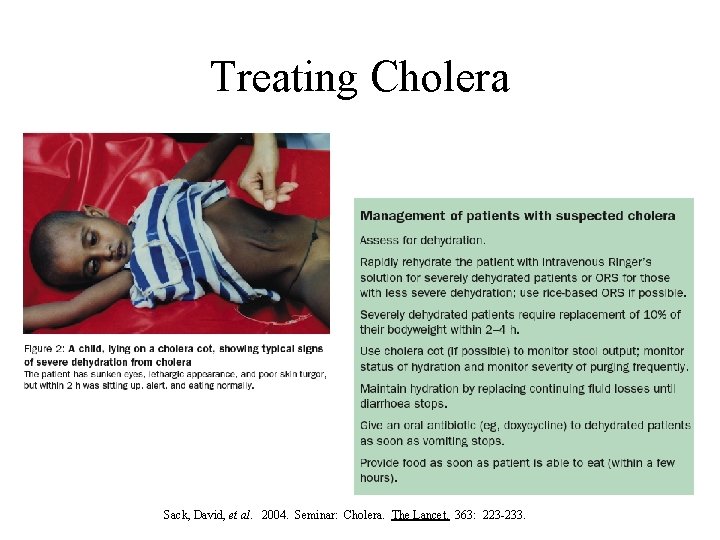 The Vibrio cholerae Toxin CoRegulated Pilus TCPtargeted Vaccine