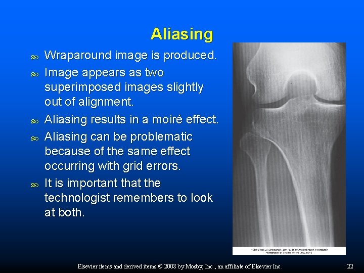 Chapter 7 Digital Radiographic Image Processing and Manipulation