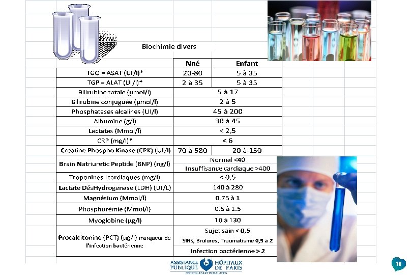 Suivi en ranimation chirurgie cardiaque pdiatrique Vronique MOUNY