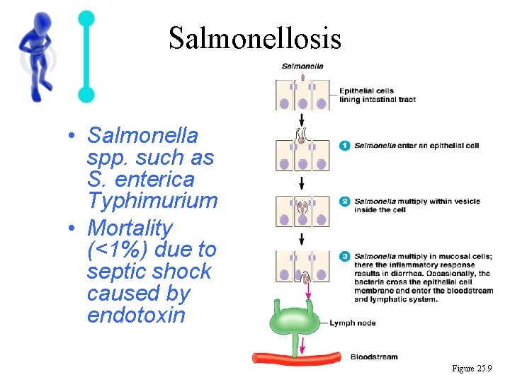 Gastrointestinal Tract Infections Done By Mona ElNa JJar