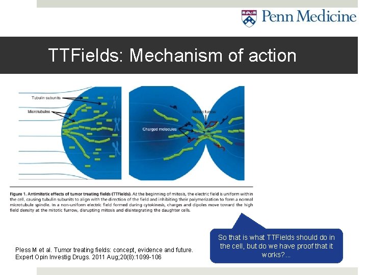 Emerging Electrical Therapy for Malignant Gliomas Impact of