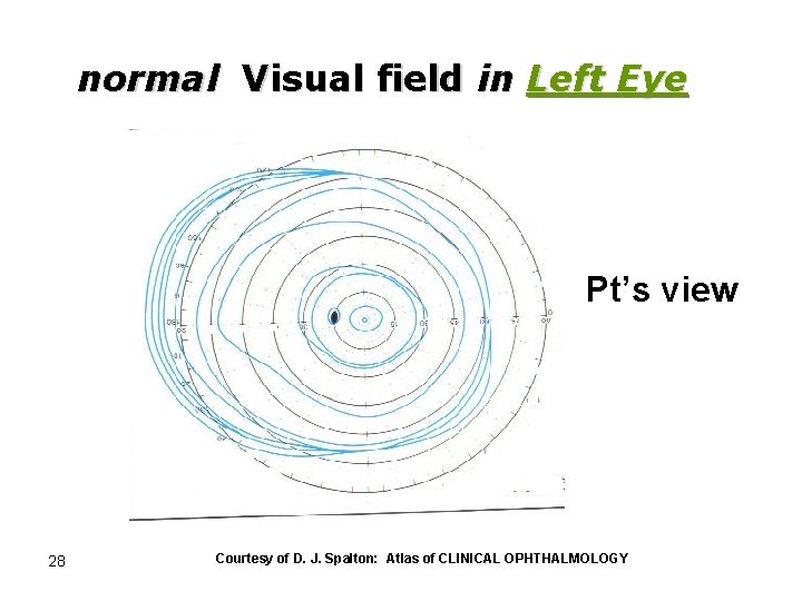 Eye manifestations during pregnancy By Dr Mohamed Abusharifa