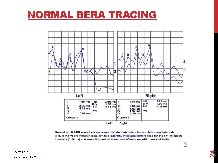 BERA DR SUPREET SINGH NAYYAR AFMC 16 07