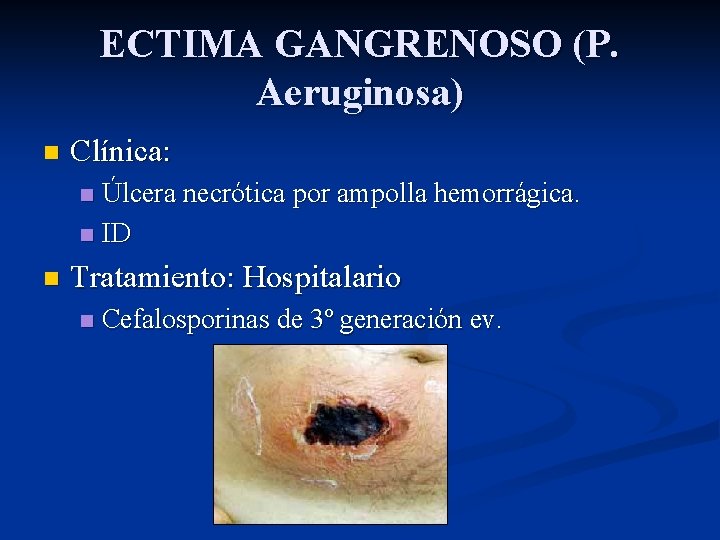 INFECCIONES DERMATOLGICAS EN ATENCIN PRIMARIA Beln Gmez Vives