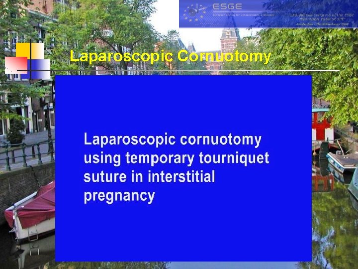 Laparoscopic cornuotomy using temporary tourniquet suture in Interstitial