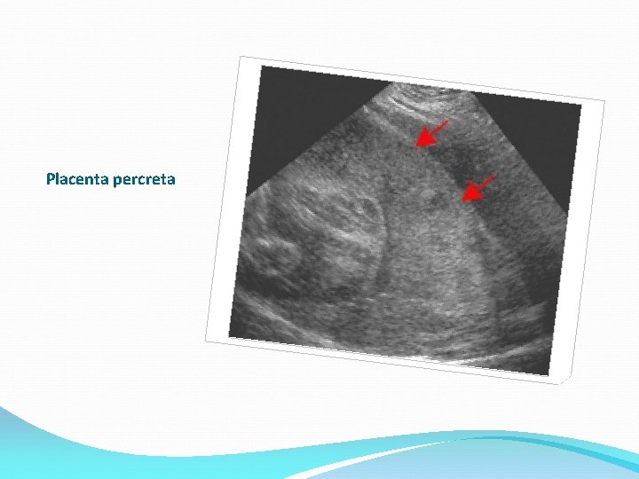 Obstetrical emergencies Nancy E Fay MD FACOG Division