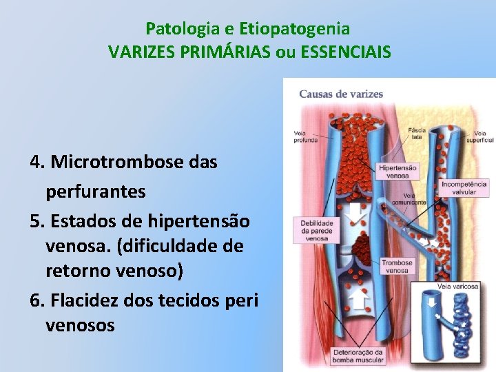 VARIZES DOS MEMBROS INFERIORES PROF ABDO FARRET NETO