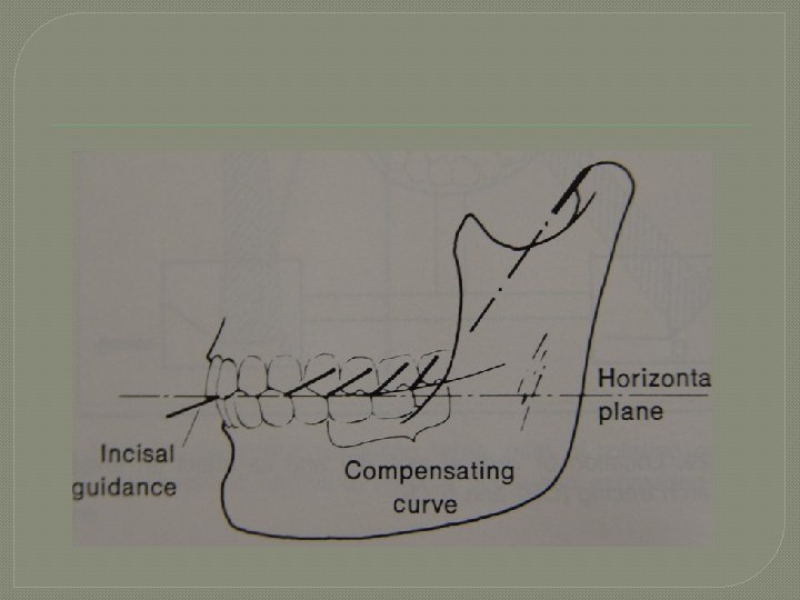 Setting posterior teeth Dr Nesreen Salim Factors affecting