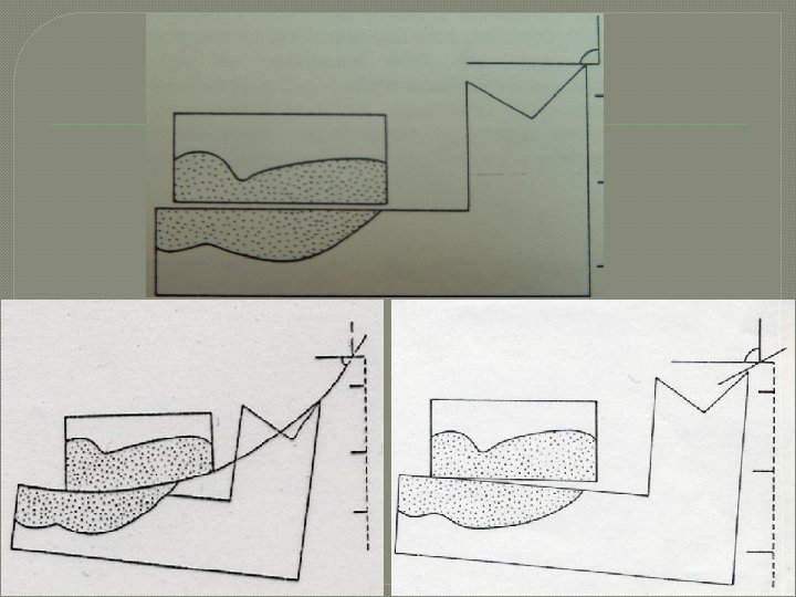 Setting posterior teeth Dr Nesreen Salim Factors affecting